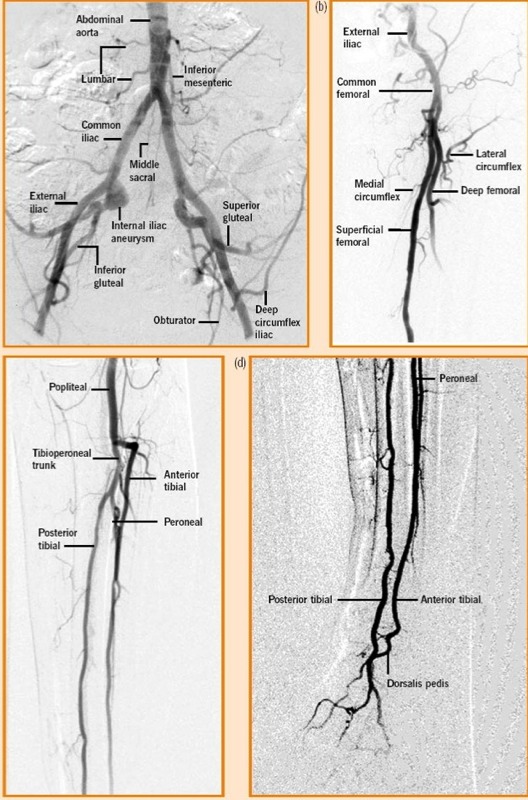 lower-extremity-arterial-anatomy